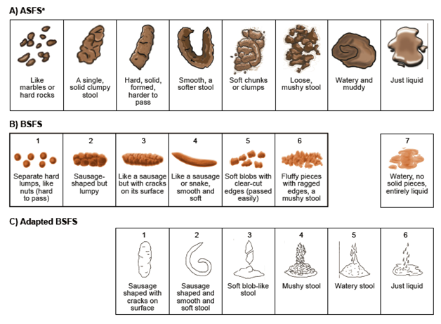 Development Of A New Instrument To Assess Stool Form And Consistency In Development Of A New Instrument To Assess Stool Form And Consistency In