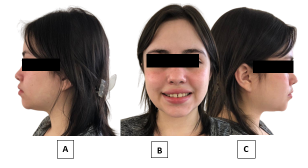 Comprehensive clinical management of stage III generalized ...