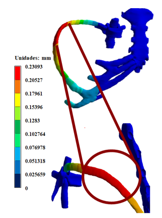 Human ribs: structure, function, and mechanical response - MedCrave online